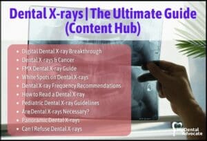 FMX Dental X-ray Guide (Are They Safe?)
